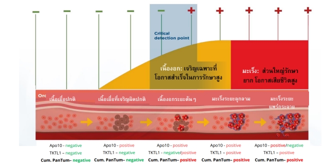 EDIM test - Akesis Life - Integrative Oncology
