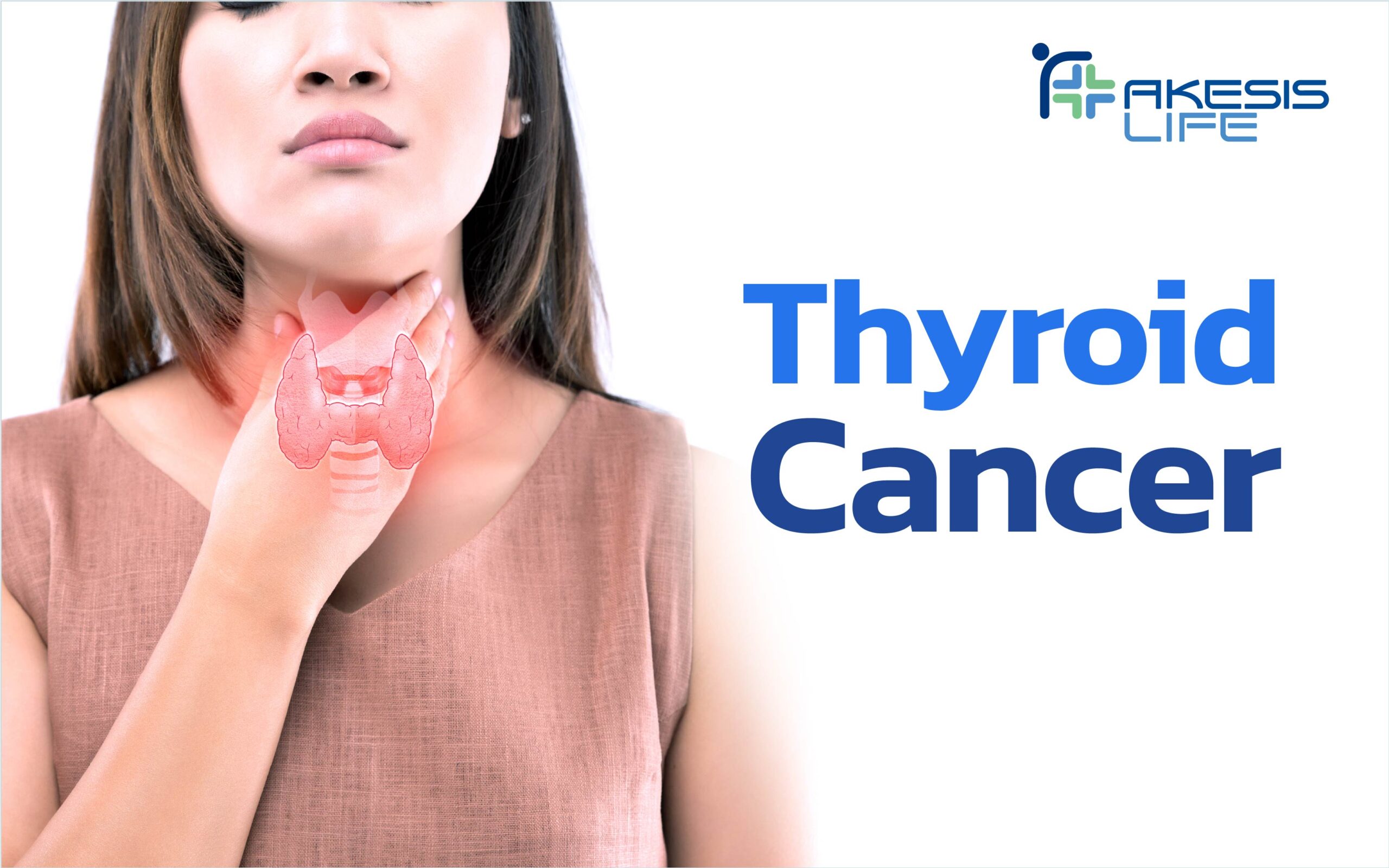 Thyroid Cancer - Akesis Life